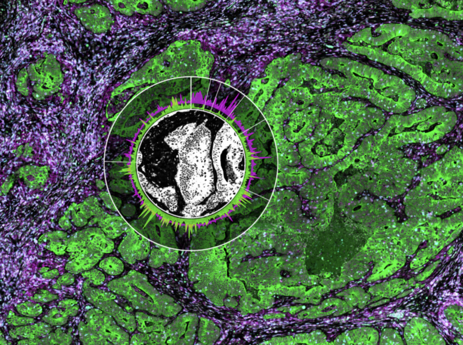NanoString GeoMx Services | Spatial Transcriptomics