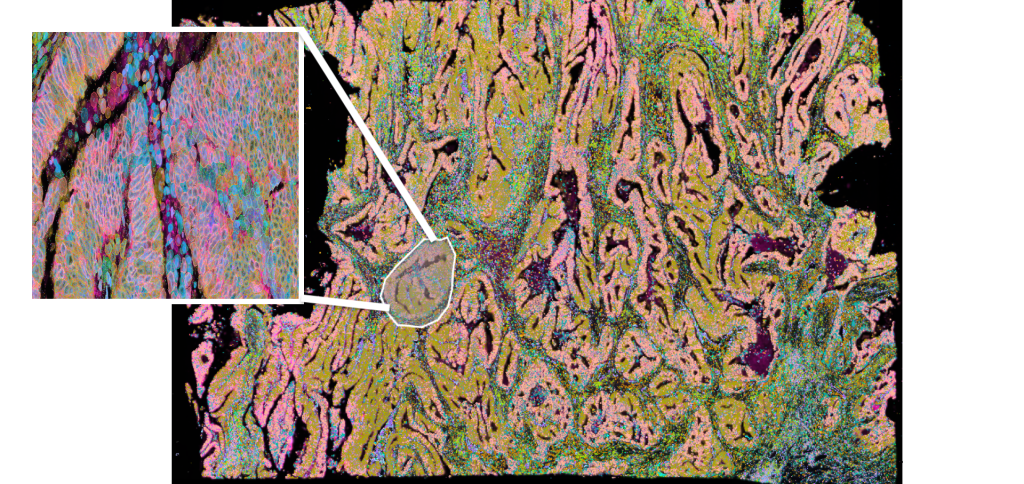 Xenium® Spatial Analyzer | BioChain Spatial Biology