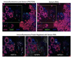 Xenium® Spatial Analyzer | BioChain Spatial Biology