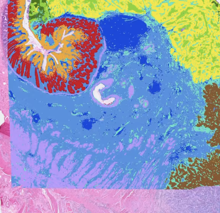 Visium Spatial Gene Expression | 10x Genomics Services